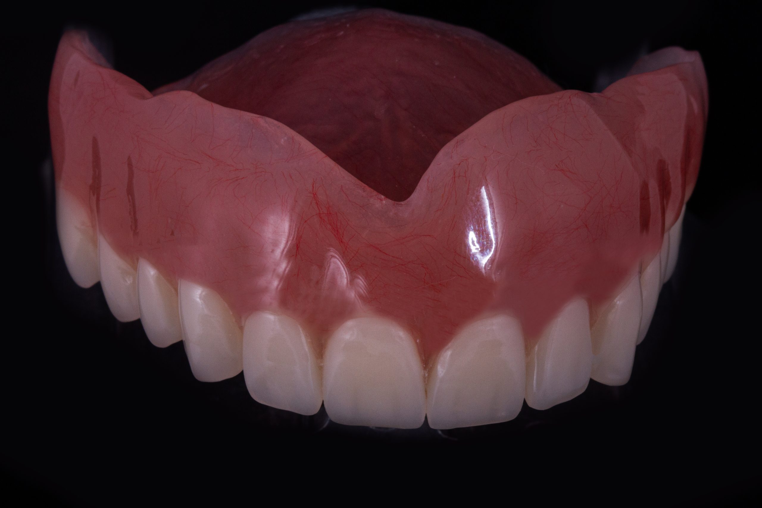 Protesis Removible | Tecno Ceramic